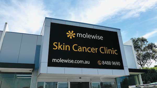 Mole Check & Skin Cancer Check Melbourne - Molewise